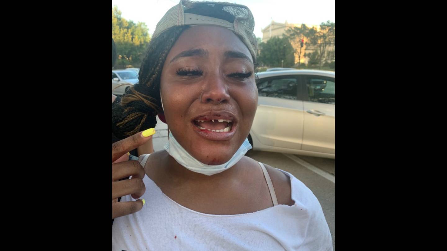 Pay Activist Miracle Boyd, Struck by Cop at 2020 Grant Park Protest ...